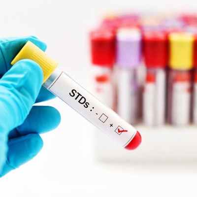 STDs Surging Across the Country - Route Fifty