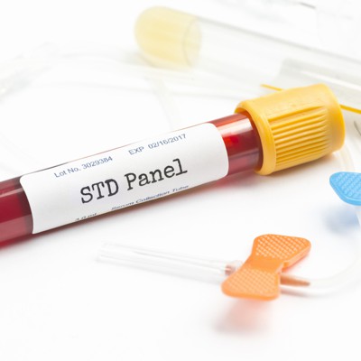 STDs Continue to Spread Nationwide - Route Fifty
